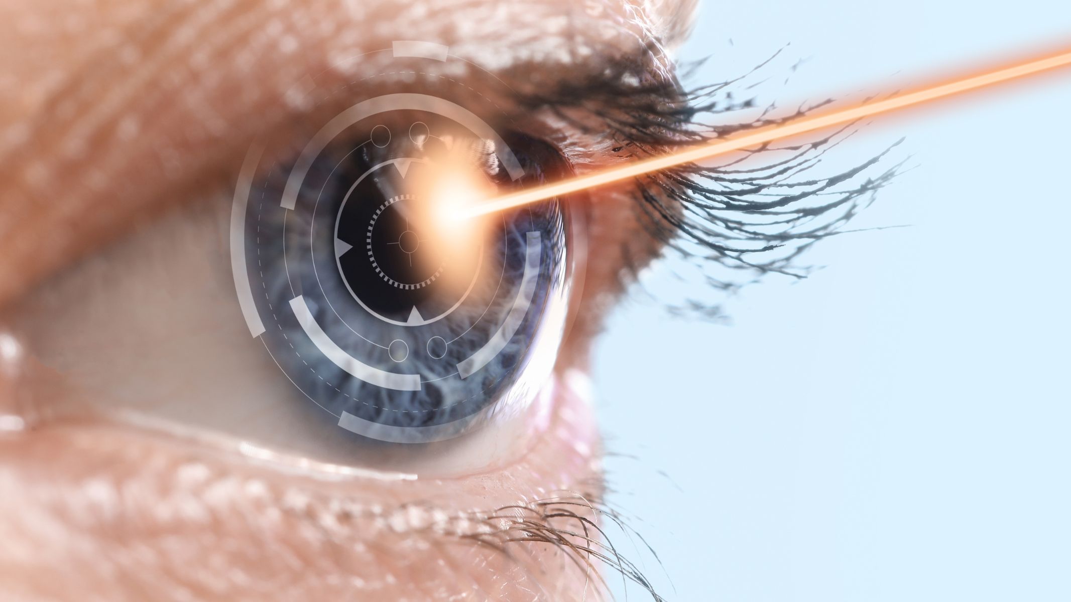 Bắn tia laser trị cận thị bao nhiêu tiền? Điều kiện bắn laser cận thị ...
