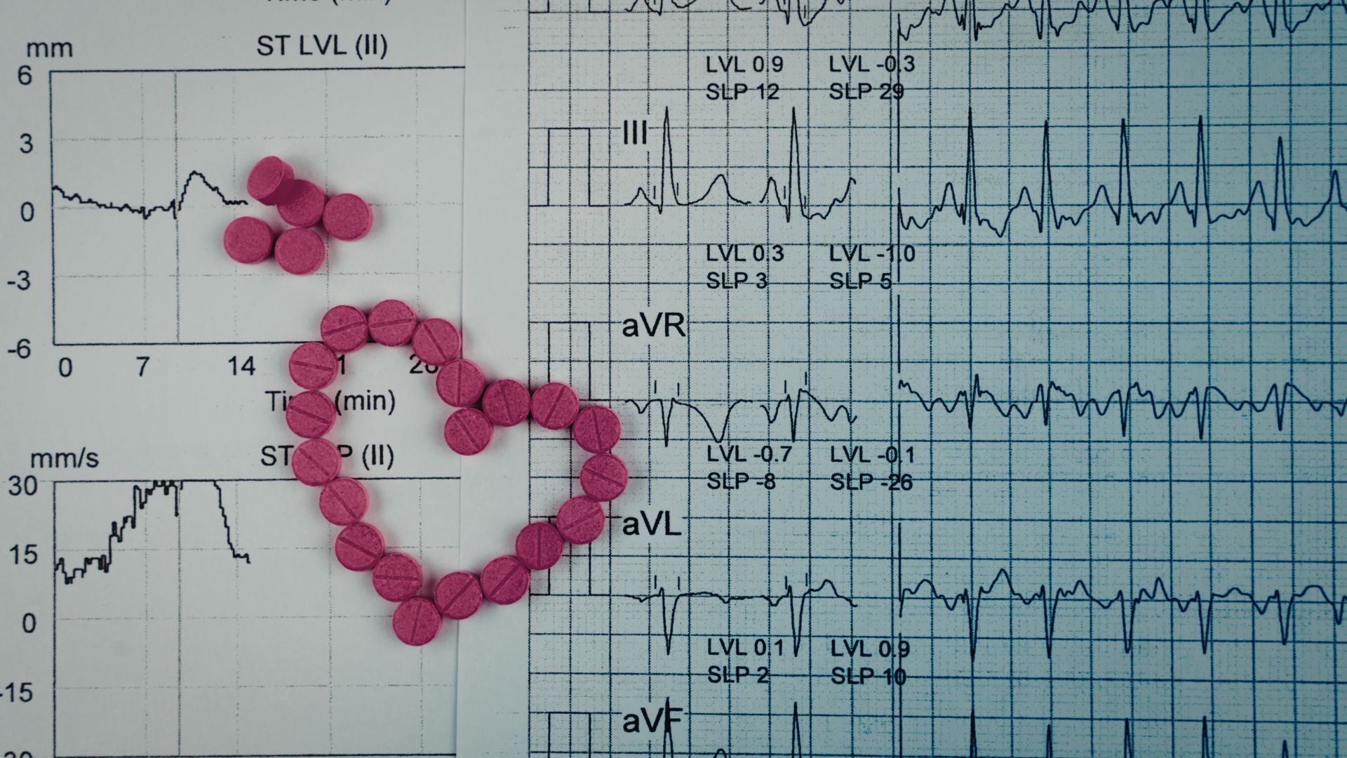 Đo ECG là gì? Quy trình đo ECG và một số lưu ý bạn cần biết - Trung tâm ...