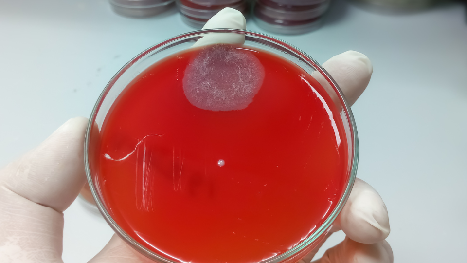 Nhuộm Gram là gì? Các bước trong quy trình thực hiện - Trung tâm Tiêm ...