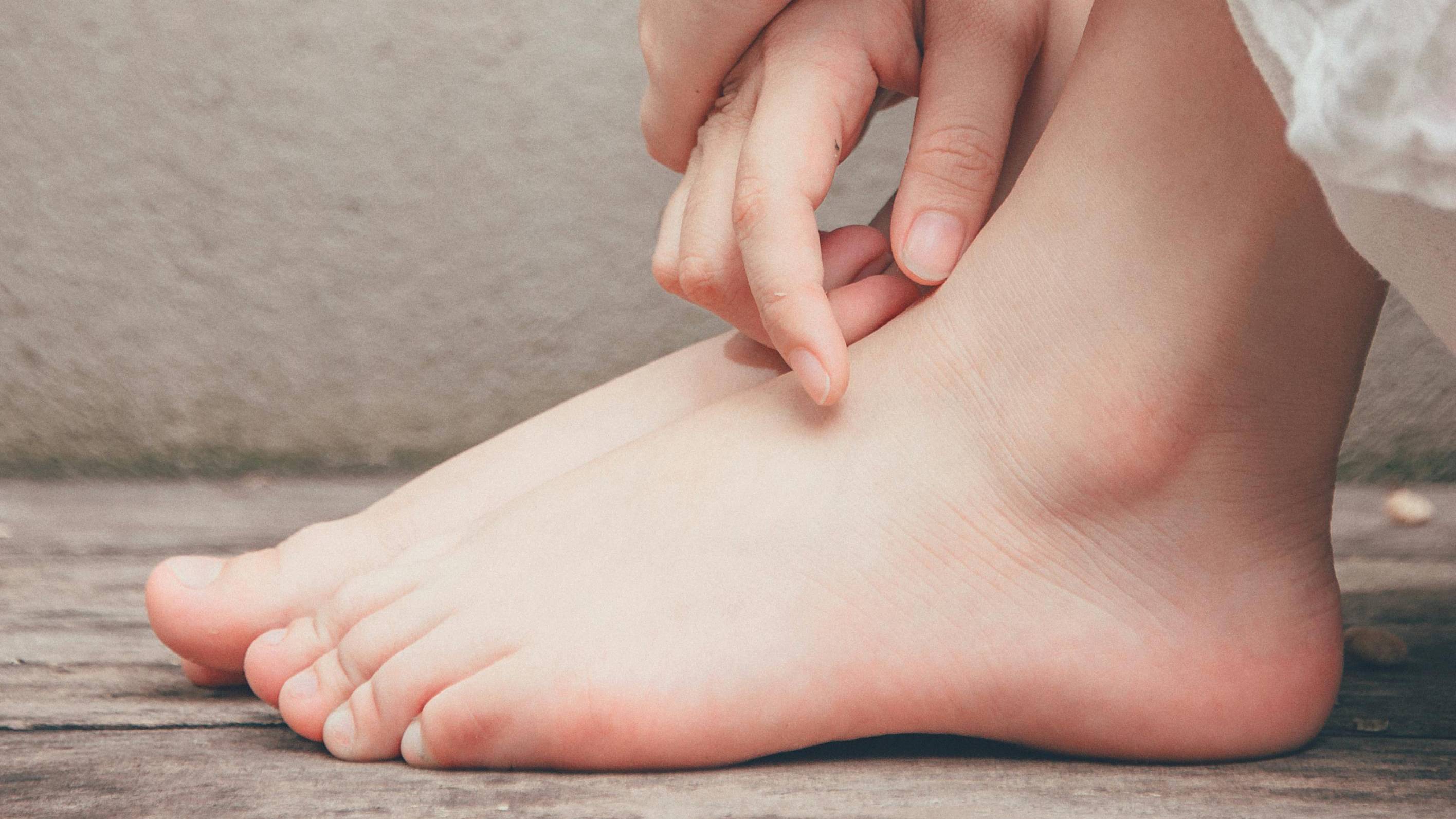 Nứt gón chân phải làm sao? Cách trị nứt gót chân tại nhà hiệu quả ...