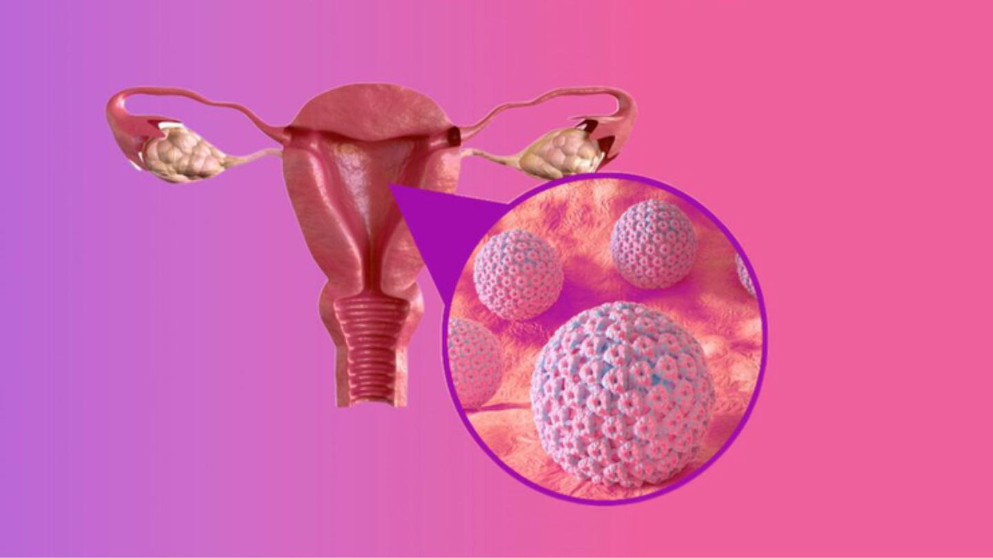 HPV 16 là gì? Có chữa được không? Có nguy cơ gây bệnh gì?
