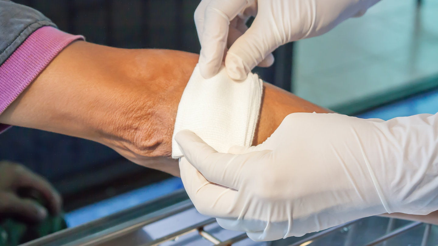 Trầy xước da phải làm sao? Những lưu ý khi bị trầy xước - Trung tâm ...