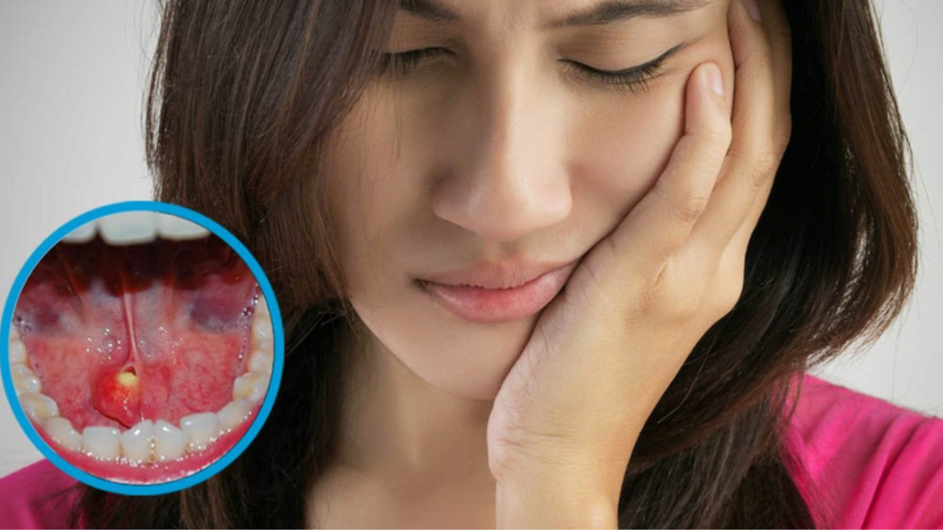 Biện pháp phòng ngừa tình trạng sưng mang tai an toàn nhất