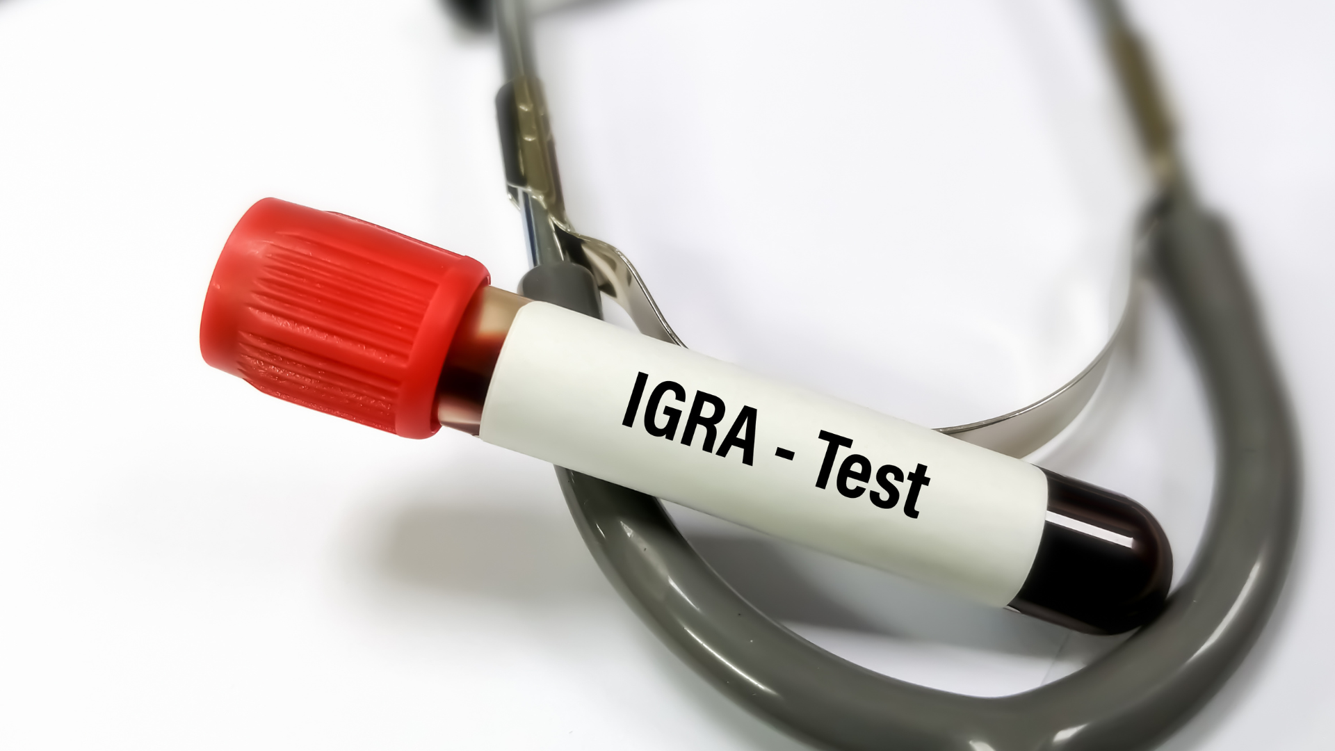 Test lao tiềm ẩn: Những điều cần biết và hướng xử lý