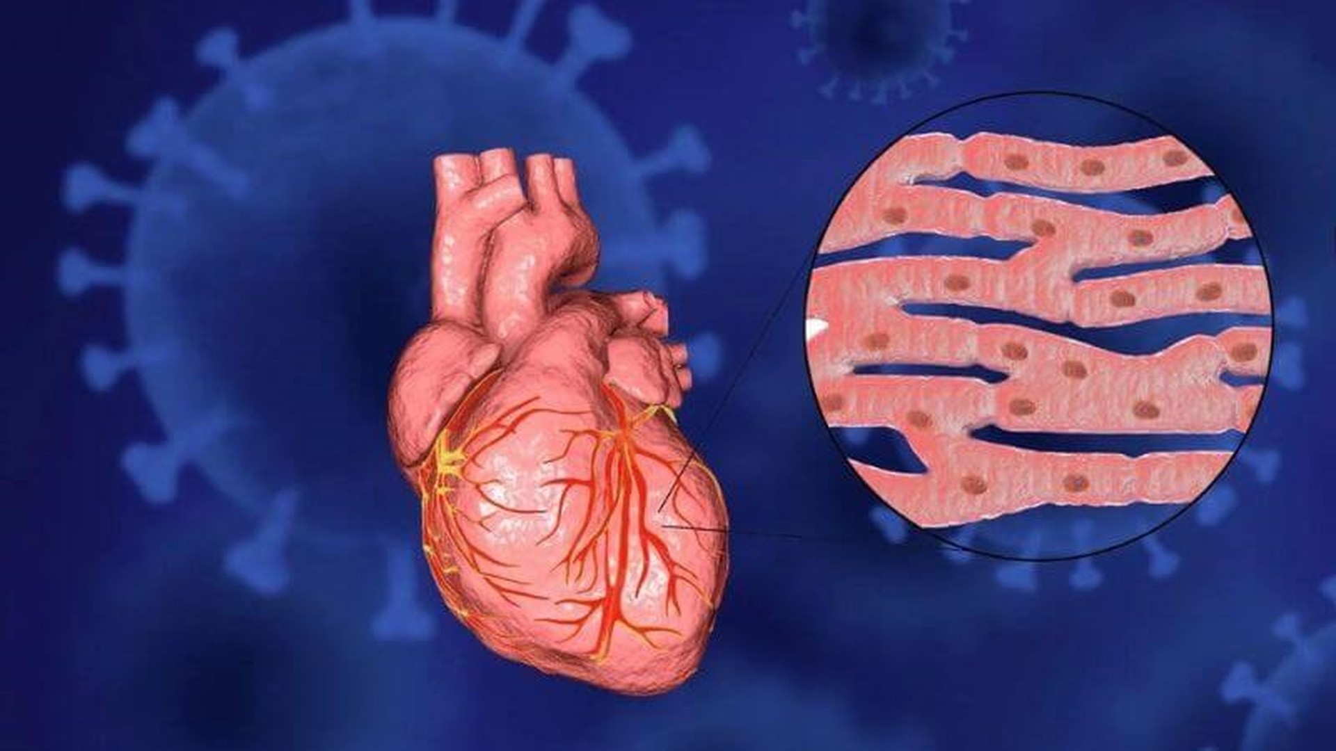 Viêm cơ tim là gì? Những vấn đề cần biết về Viêm cơ tim - Trung tâm ...