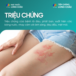 Zona thần kinh: Triệu chứng, nguyên nhân và cách phòng ngừa - Trung tâm ...