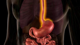 Barrett thực quản là gì? Triệu chứng, nguyên nhân và cách điều trị ...