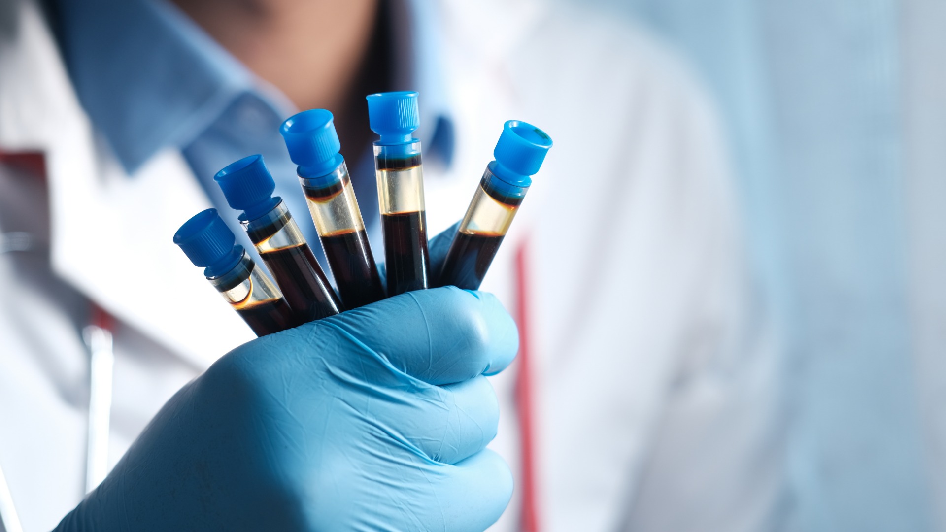 Xét nghiệm nhóm máu bao nhiêu tiền? Chi phí và lưu ý an toàn - Trung tâm Tiêm chủng Long Châu